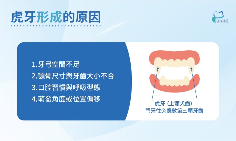 虎牙一定要矯正嗎？矯正全攻略：方法、費用與術後護理一次看懂 | 玉美學牙醫診所